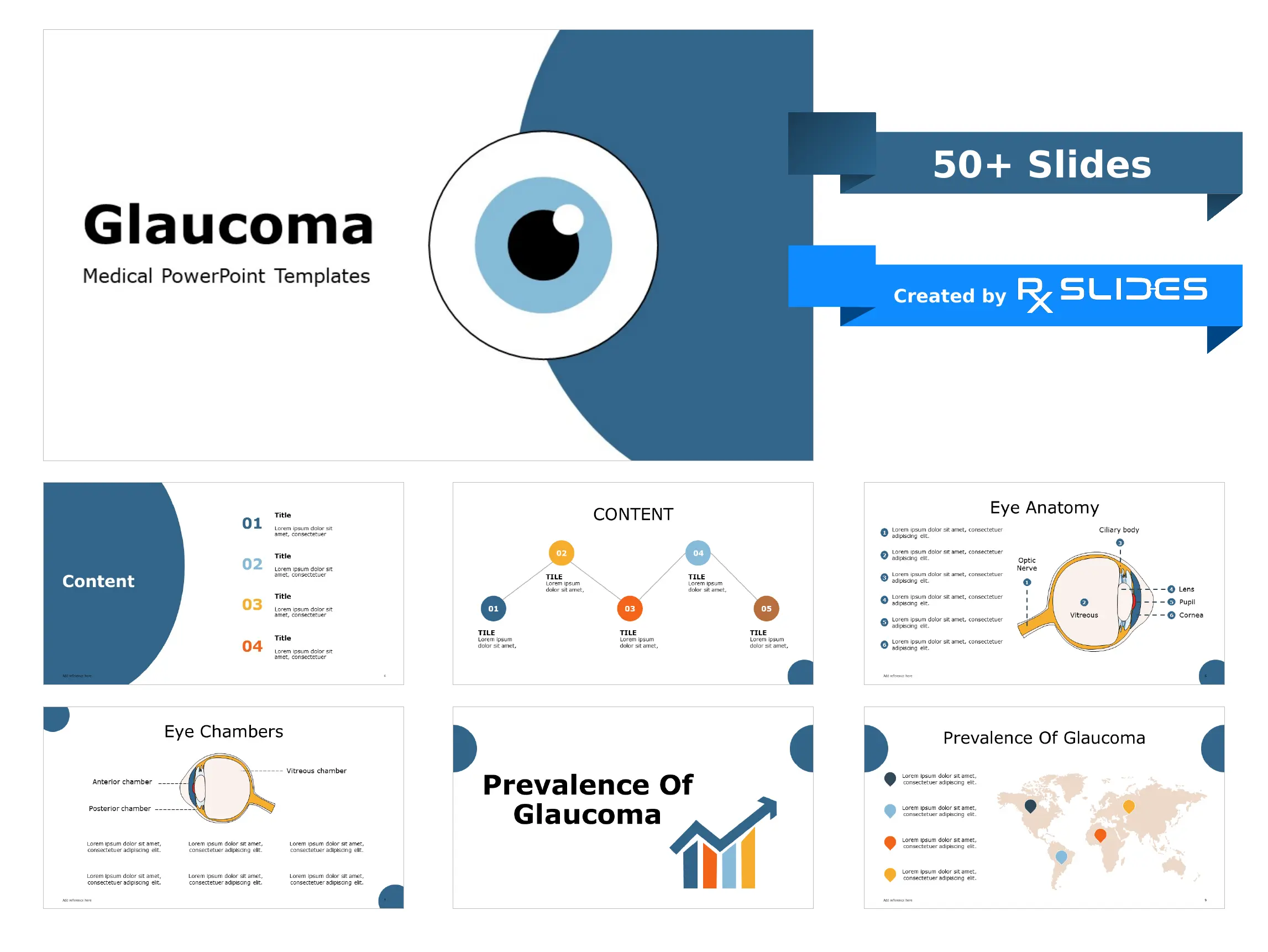 Download Glaucoma PowerPoint Template| RxSlides